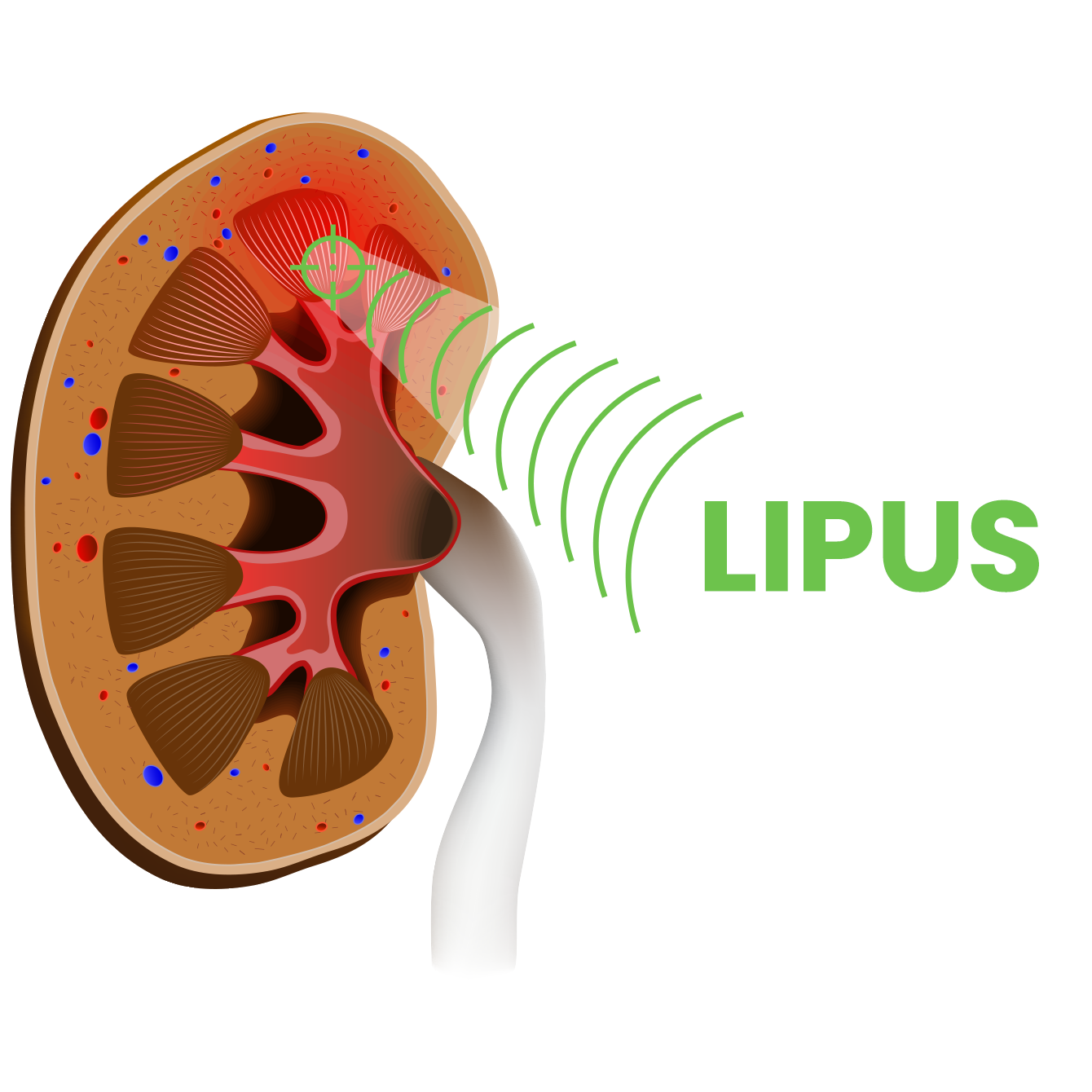 LIPUS Technology – AnaSonic